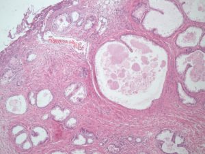 Próstata | Atlas Virtual de Histologia