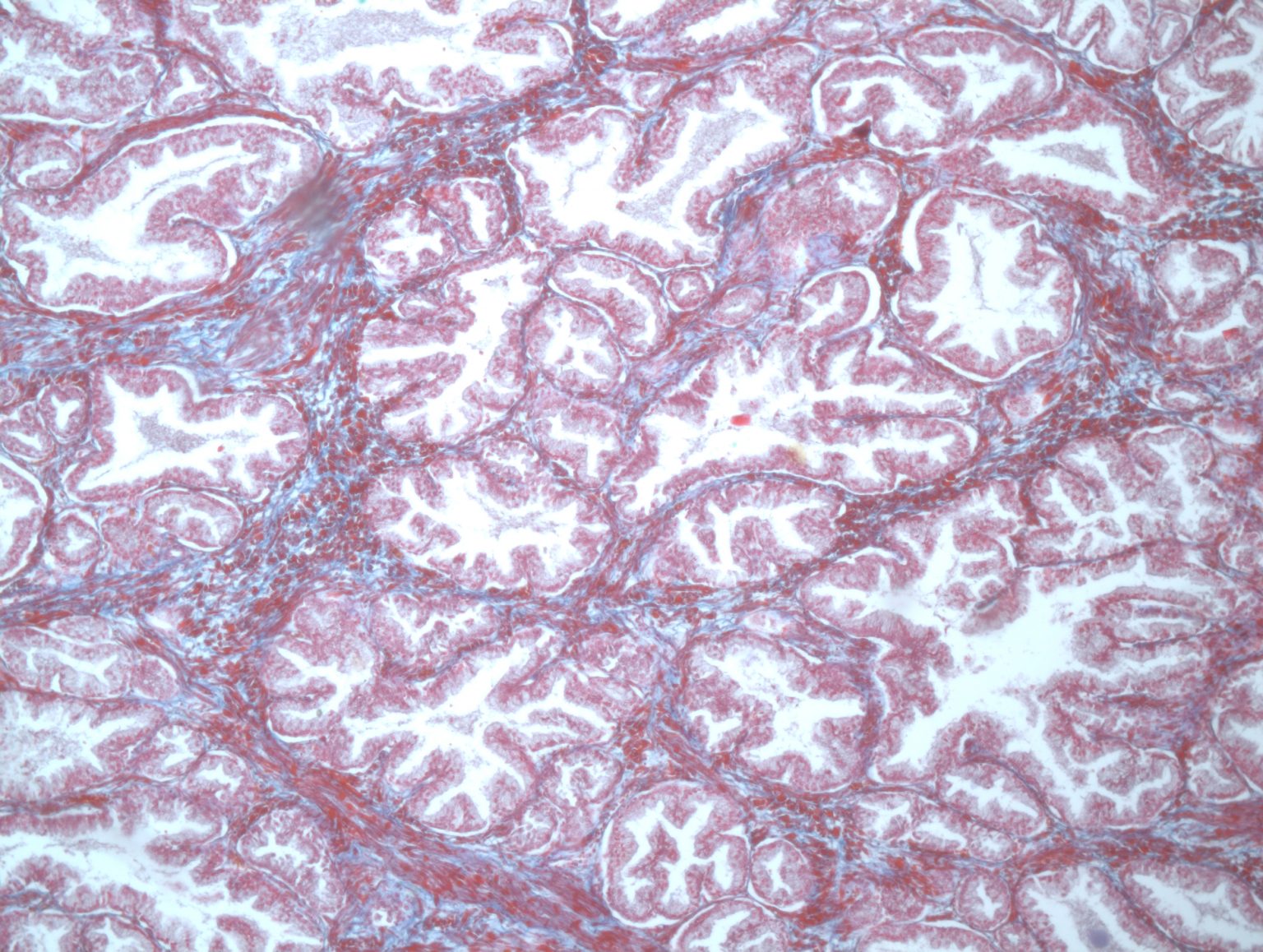 Próstata | Atlas Virtual de Histologia