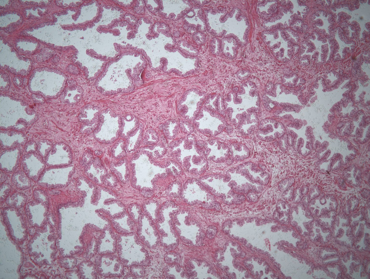 Próstata | Atlas Virtual de Histologia