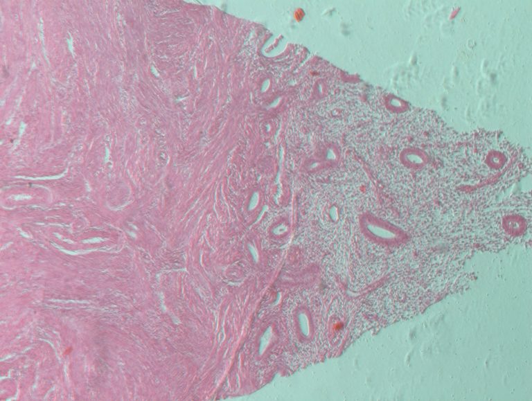 Útero | Atlas Virtual de Histologia