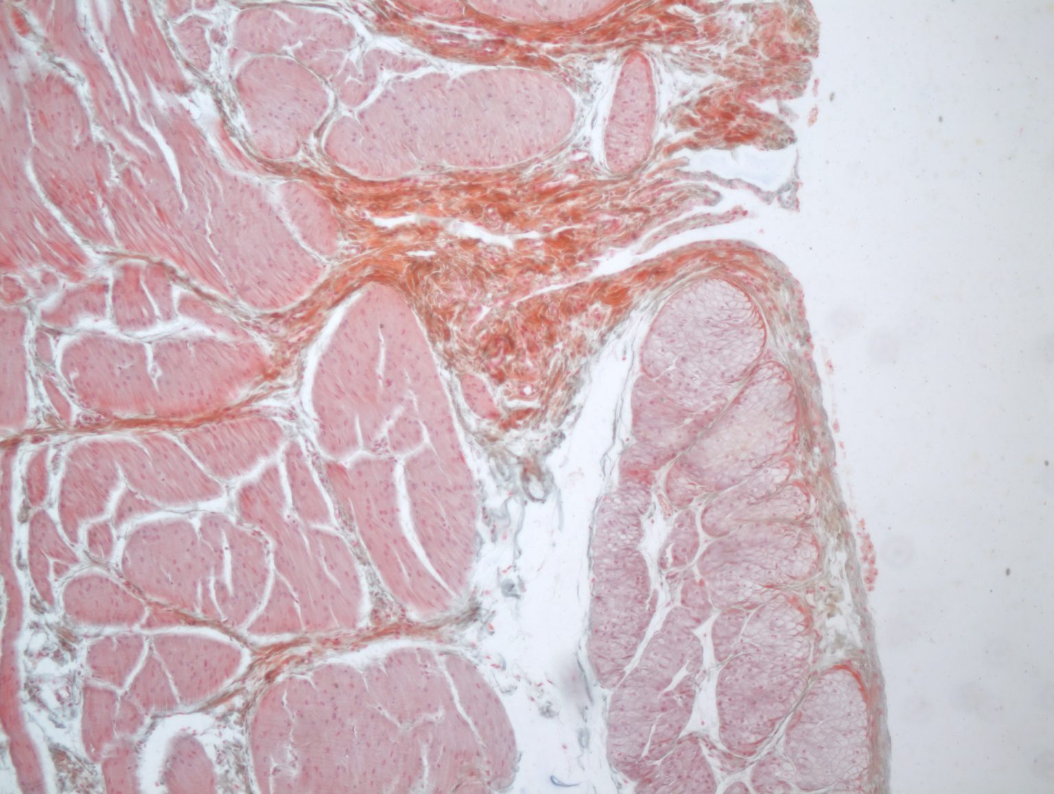 Bexiga | Atlas Virtual de Histologia