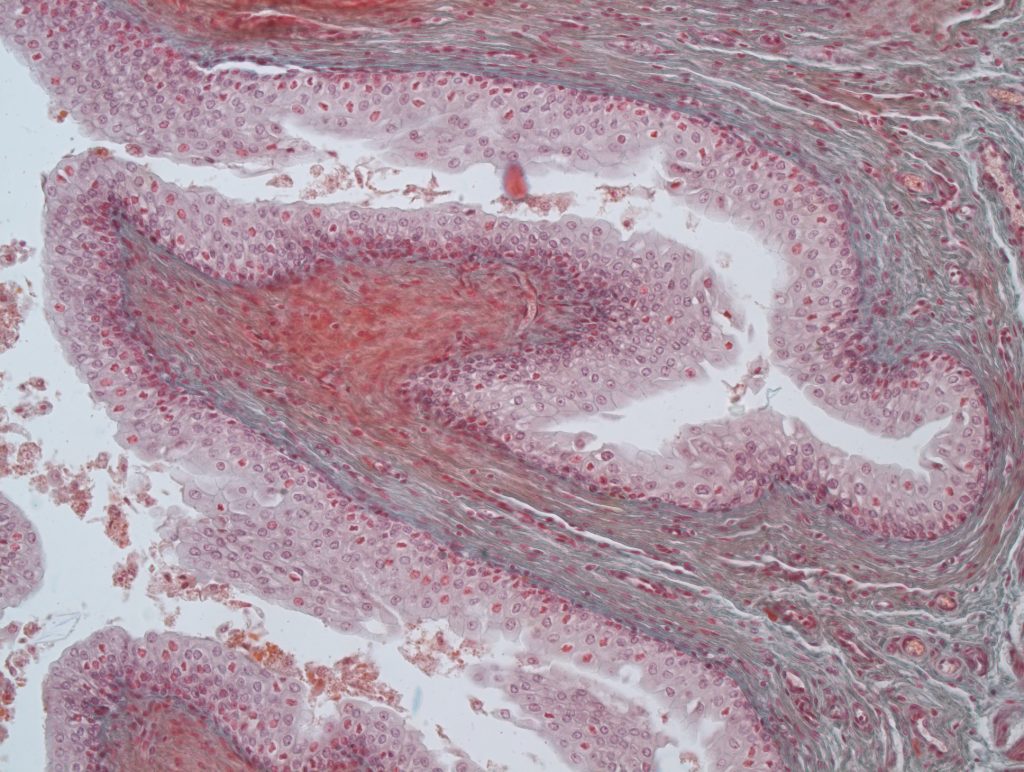 Bexiga | Atlas Virtual de Histologia