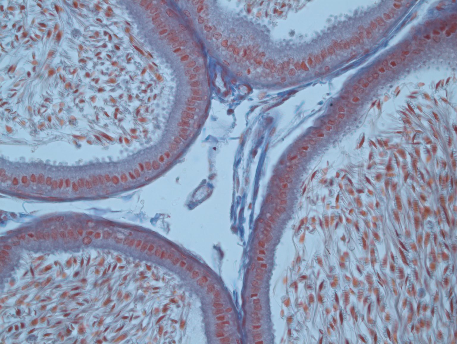 Epidídimo | Atlas Virtual de Histologia
