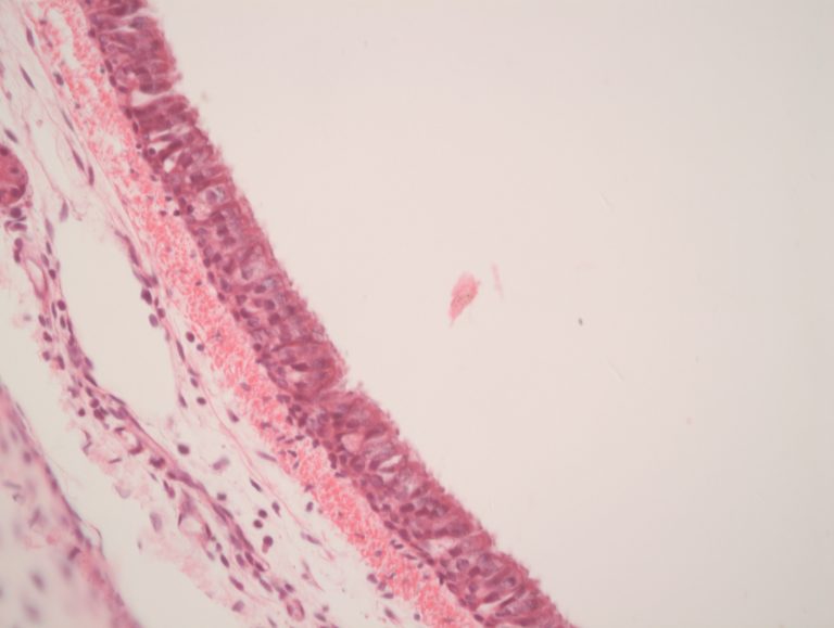 Traqueia | Atlas Virtual de Histologia
