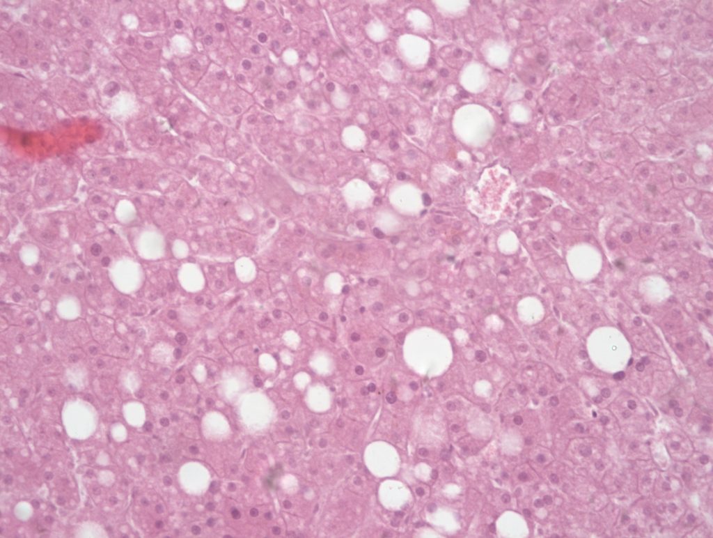 Fígado | Atlas Virtual de Histologia